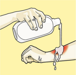 Understanding Burn Codes Just Made Easy – Symbiosis Revenue Cycle ...